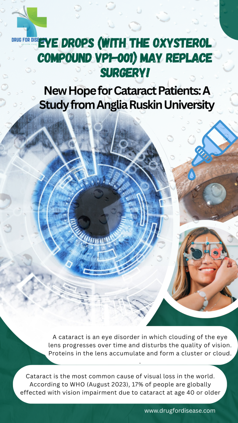 New eye drops with oxysterol compound (VP1-001) may treat cataracts ...